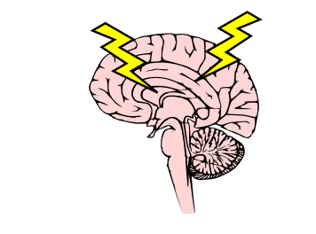 The use and abuse of brain stimulation - Motor Impairment